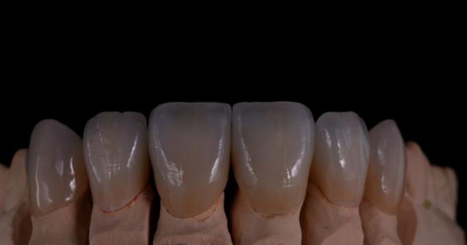 Altos discos dentales translúcidos 1050 de la circona del Mpa del 57% ...